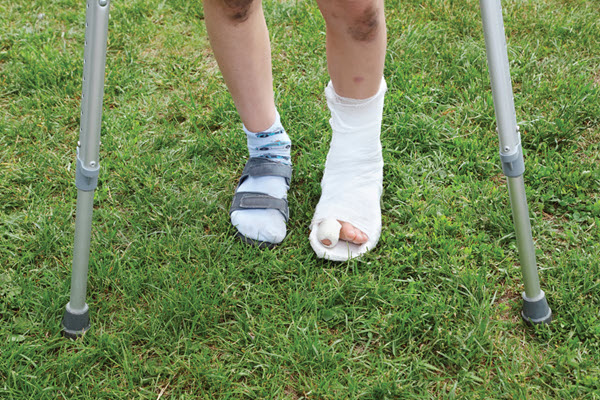 Break Down Pathologic Fracture Coding for the Best Dx : FAQs