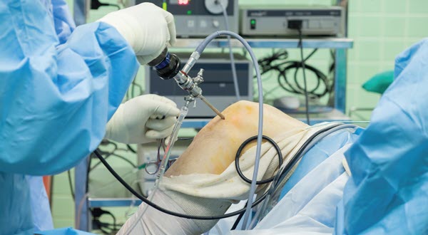 Know Dx, Surgical Differences on Knee Arthroscopies : Surgery Coding ...