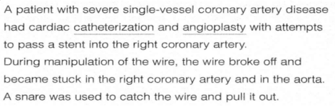 Snaring technique for removal broken guidewire during Cardiac Cath procedure | Medical Billing ...